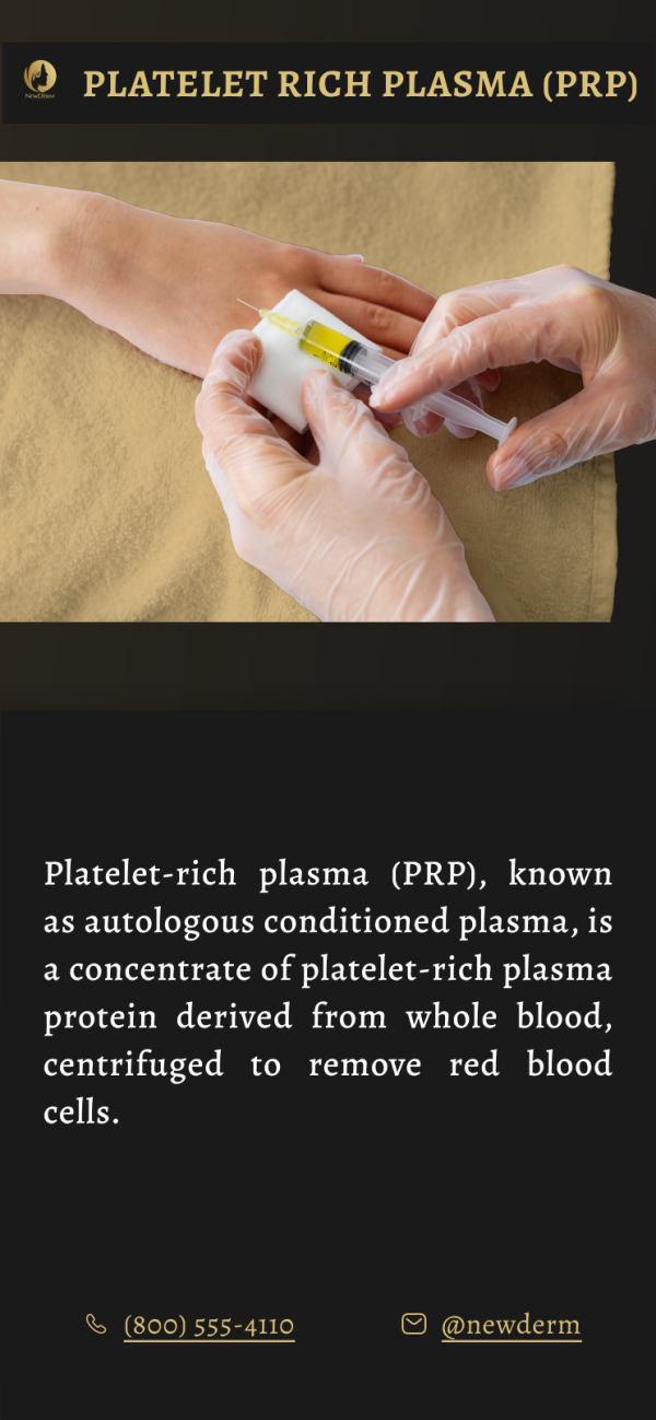 PLATELET-RICH PLASMA (PRP) - NewDrem